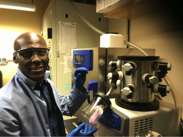 A Diagnosis that Led to Life’s Mission: Working to Reverse Alopecia ...